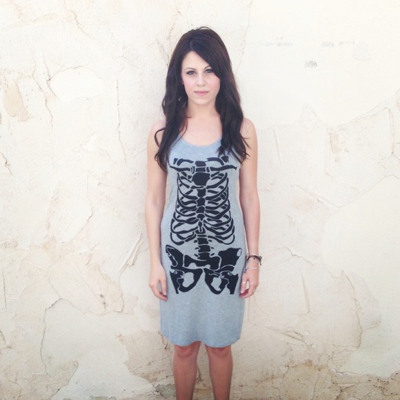 Dresses | X Ray Dress | Poshmark