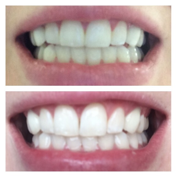 Other | Ap24 Toothpaste | Poshmark