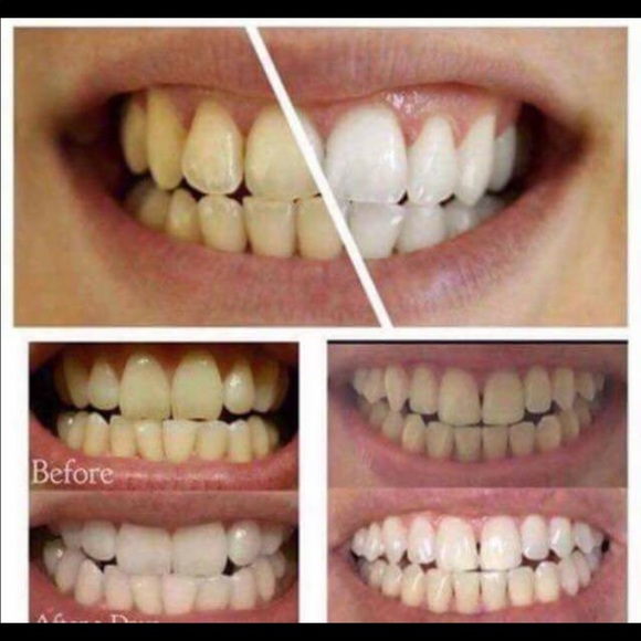 AP24 | Other | Toothpaste To Hit The Market | Poshmark